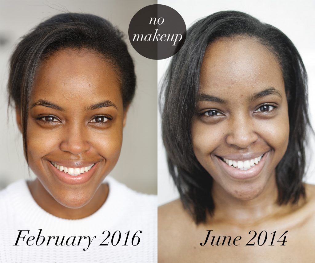 #BeautyBar: 5 Things girls with perfect skin will ALWAYS do - Capital ...